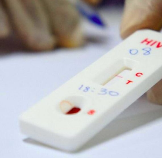 HIV: quais são os tipos de teste e quando é necessário fazer? | Dois Terços